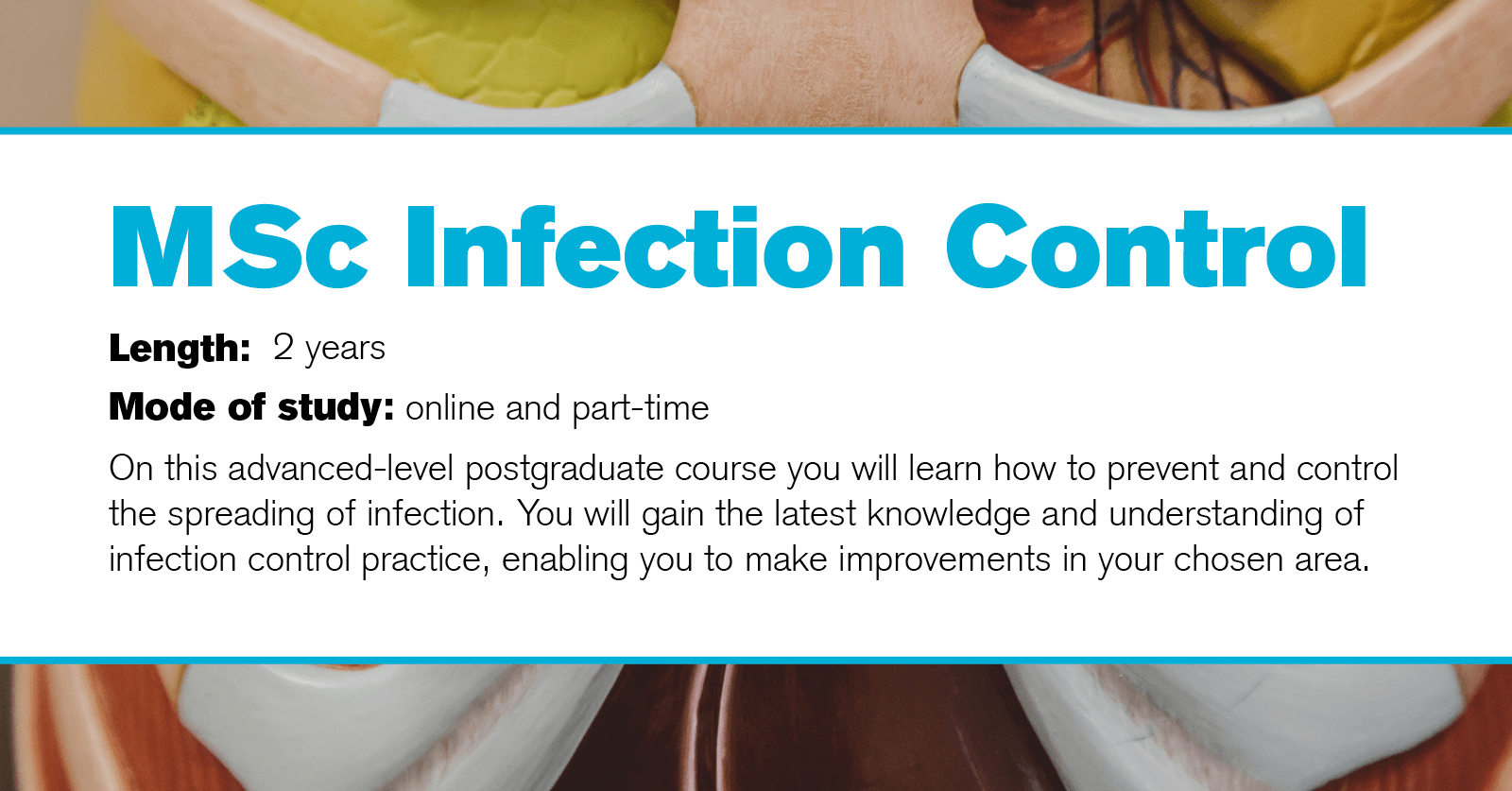 MSc Infection Control Online Degree | University of Essex Online